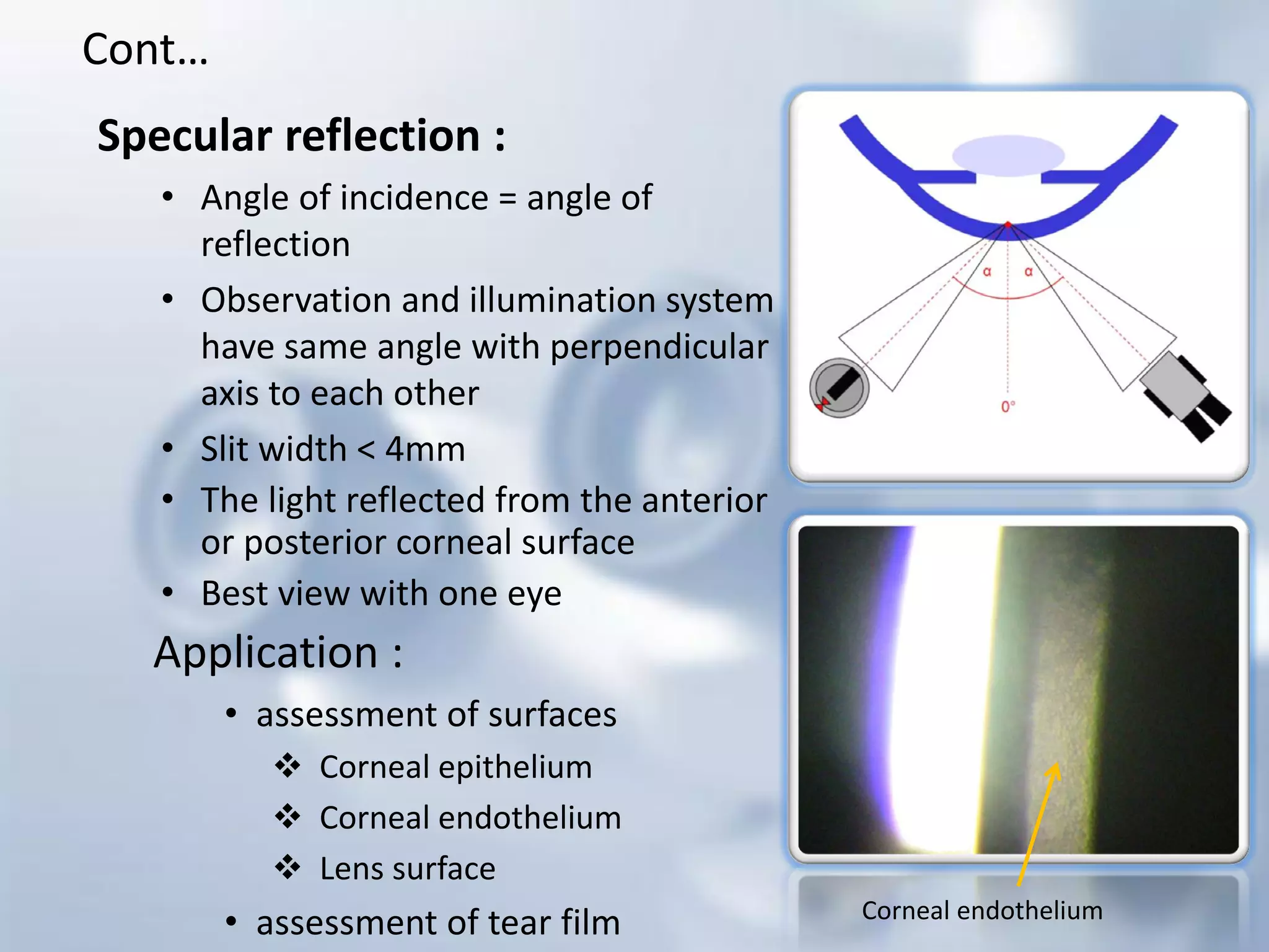 Slit lamp biomicroscope | PDF