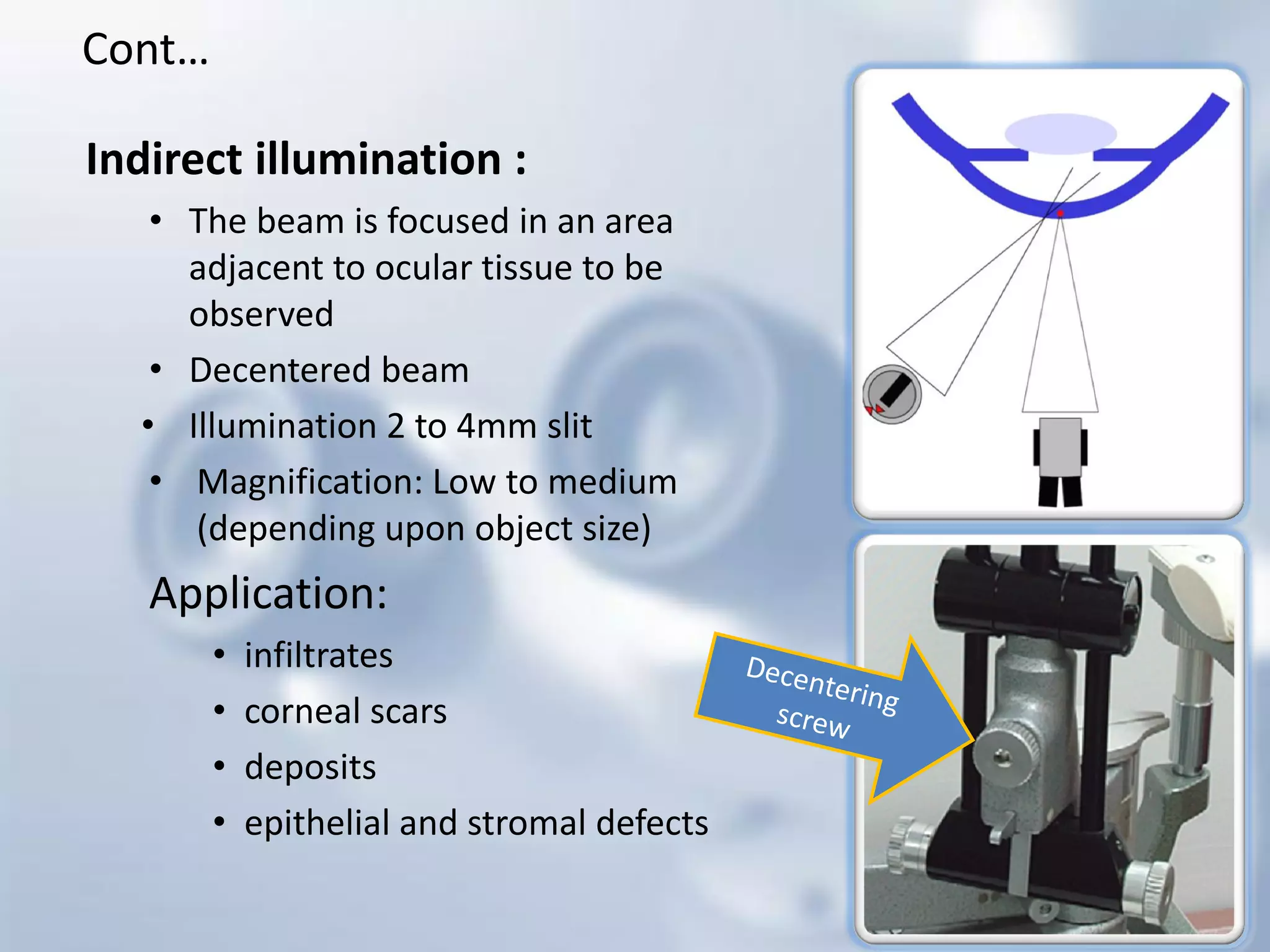 Slit lamp biomicroscope | PDF
