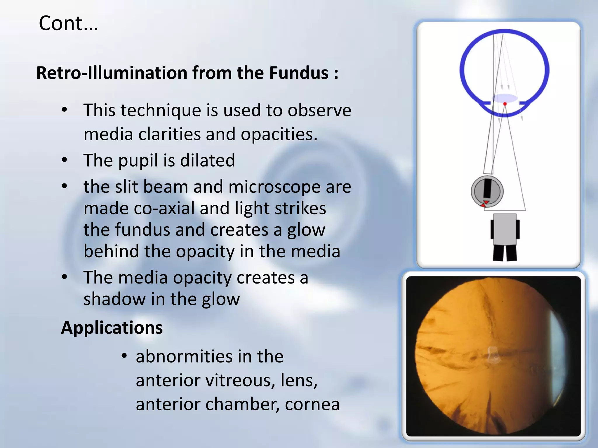 Slit lamp biomicroscope | PDF