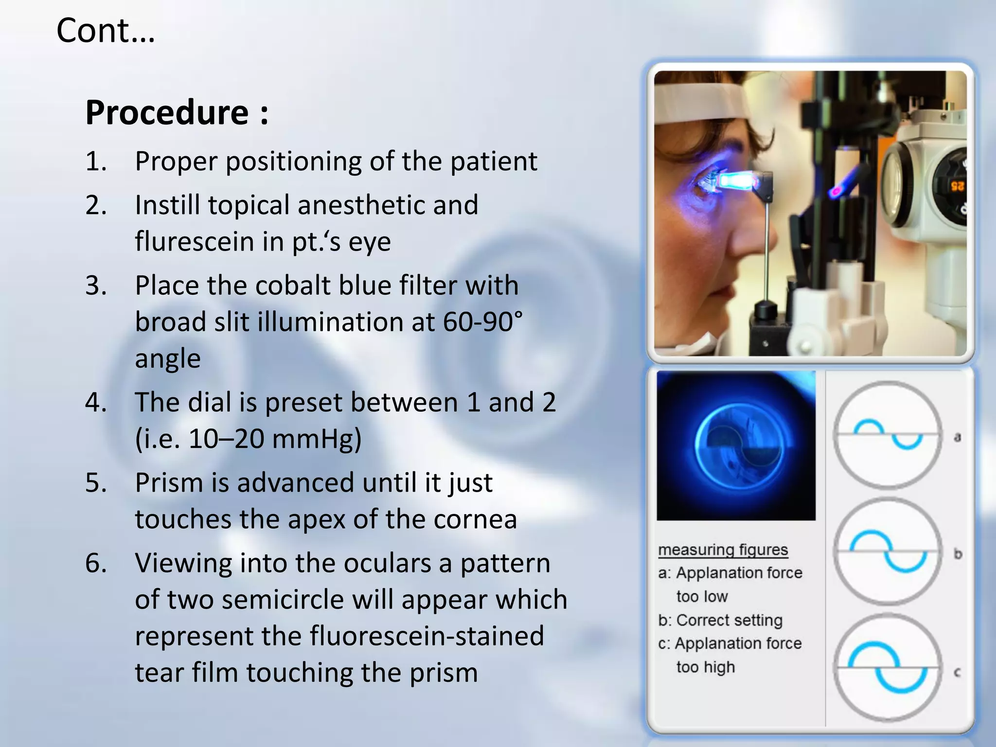 Slit lamp biomicroscope | PDF