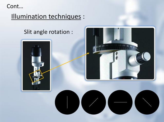 Slit lamp biomicroscope | PDF | Eye and Vision Conditions | Diseases ...