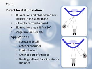 Slit lamp biomicroscope | PDF