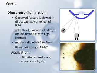 Slit lamp biomicroscope | PDF