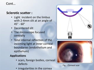 Slit lamp biomicroscope | PDF