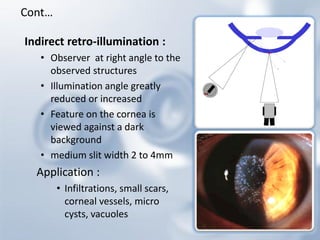Slit lamp biomicroscope | PPT