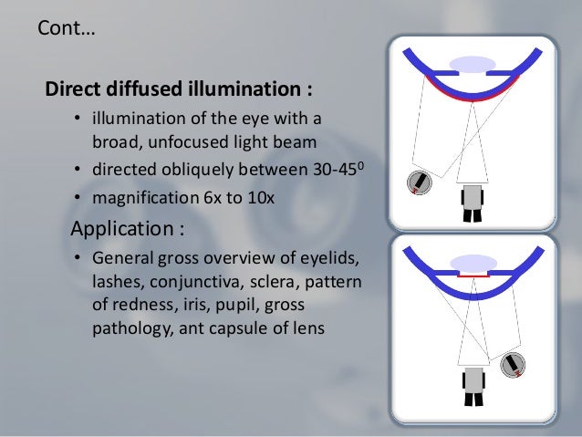 Slit lamp biomicroscope
