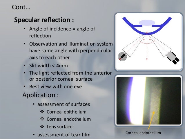 Slit lamp biomicroscope