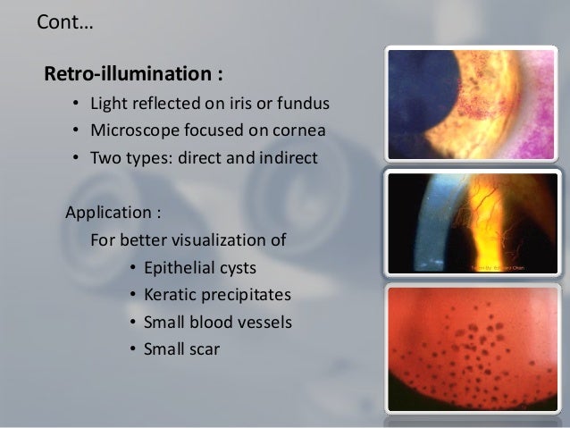 Slit lamp biomicroscope