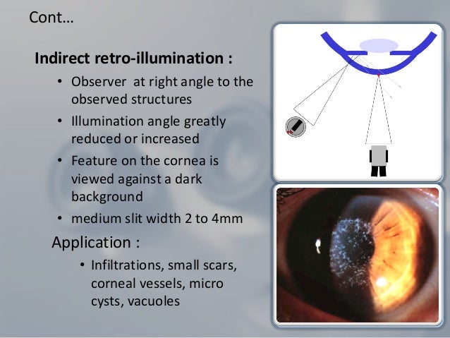 Slit lamp biomicroscope