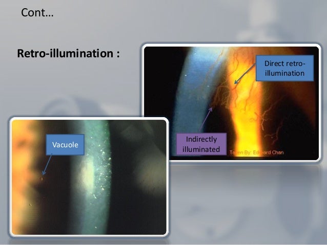 Slit lamp biomicroscope