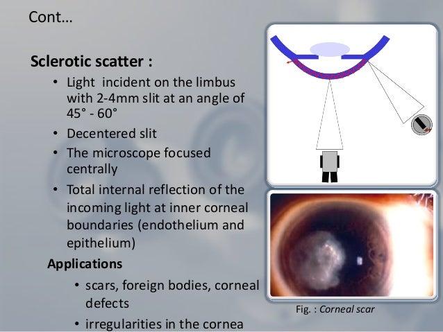Slit lamp biomicroscope