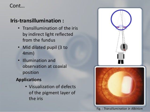 Slit lamp biomicroscope