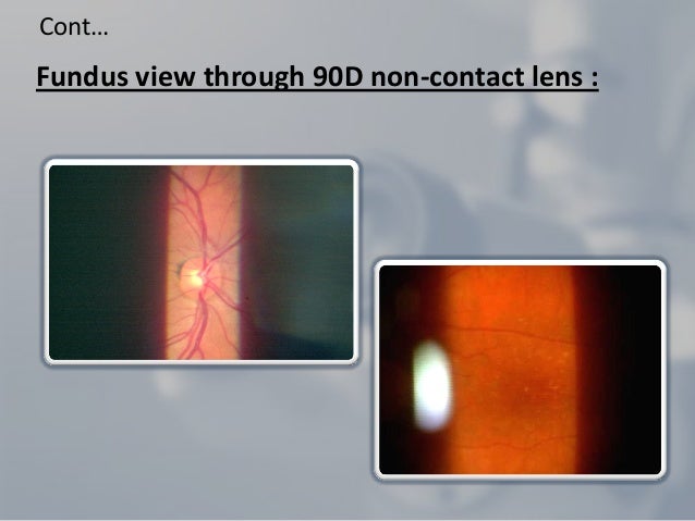 Slit lamp biomicroscope