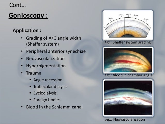 Slit lamp biomicroscope