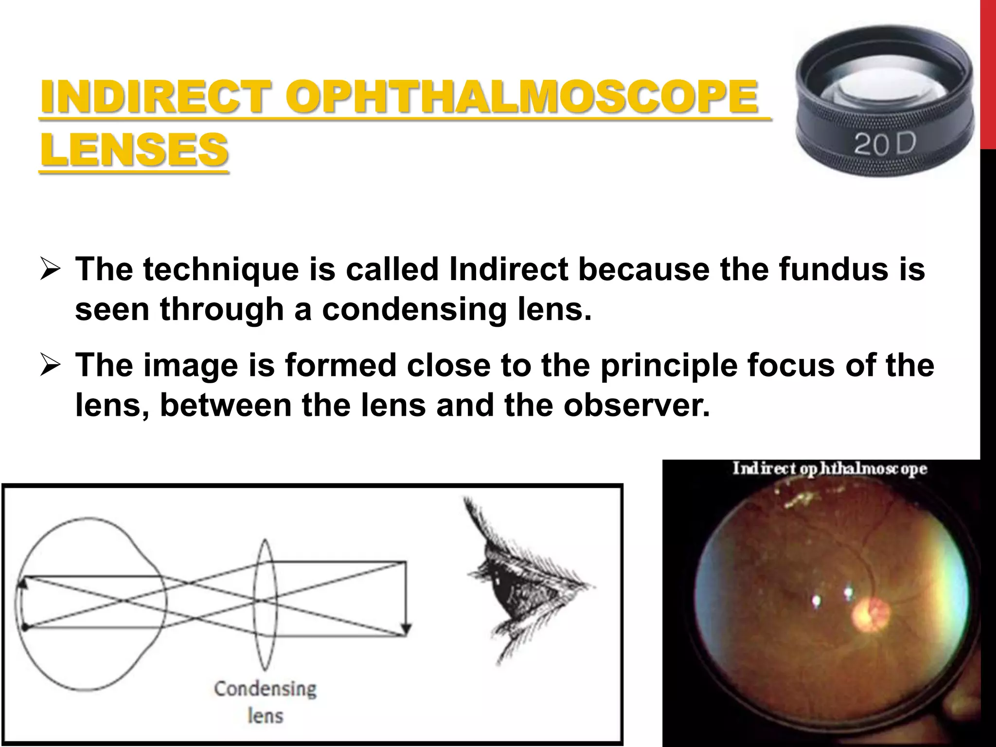 Lenses of slit lamp biomicroscope & indirect ophthalmoscope. | PPTX