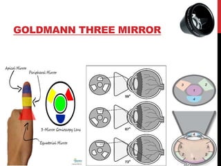 Lenses of slit lamp biomicroscope & indirect ophthalmoscope. | PPTX
