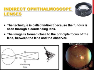Lenses of slit lamp biomicroscope & indirect ophthalmoscope. | PPTX