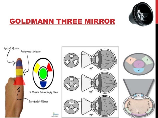 Lenses of slit lamp biomicroscope & indirect ophthalmoscope.