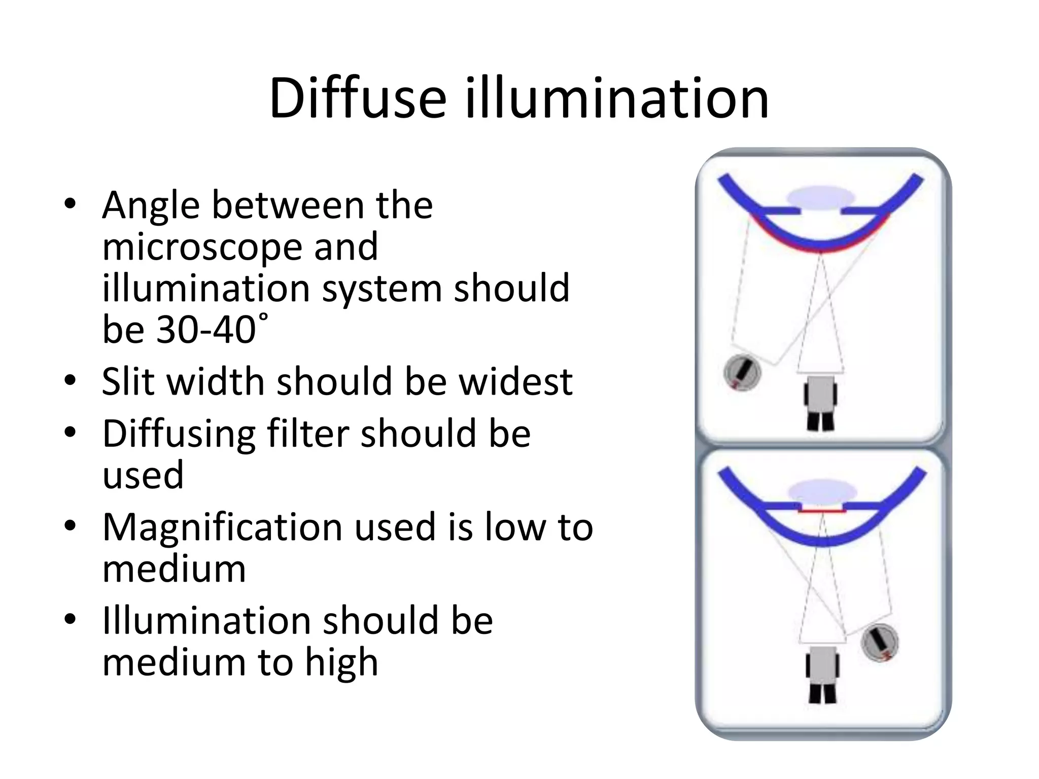 Slit lamp biomicroscopy and illumination techniques | PPTX