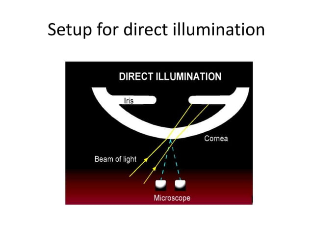 Slit lamp biomicroscopy and illumination techniques | PPTX | Eye and ...