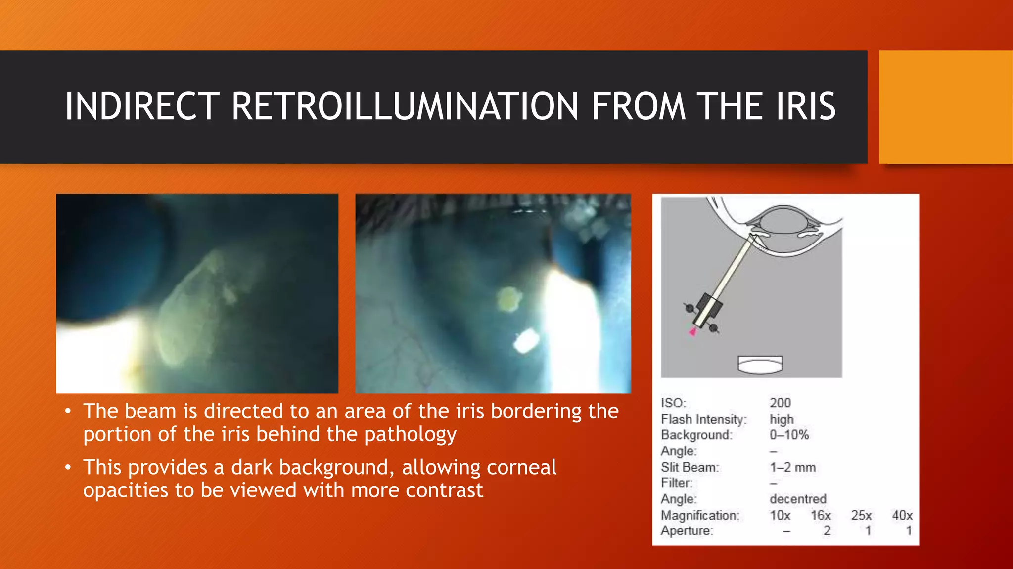 Slit lamp (methods of illumination) | PPTX