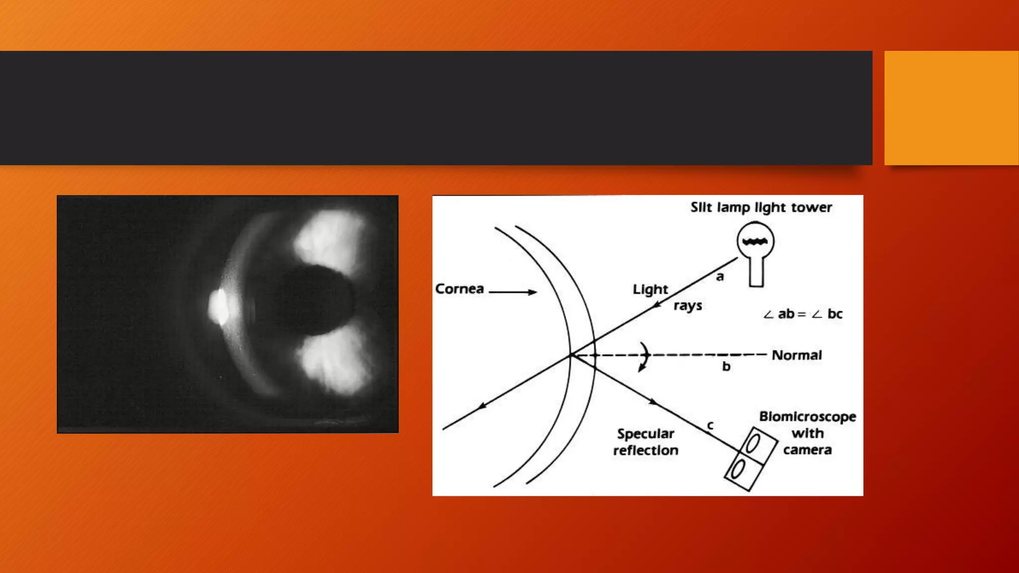Slit lamp (methods of illumination) | PPTX