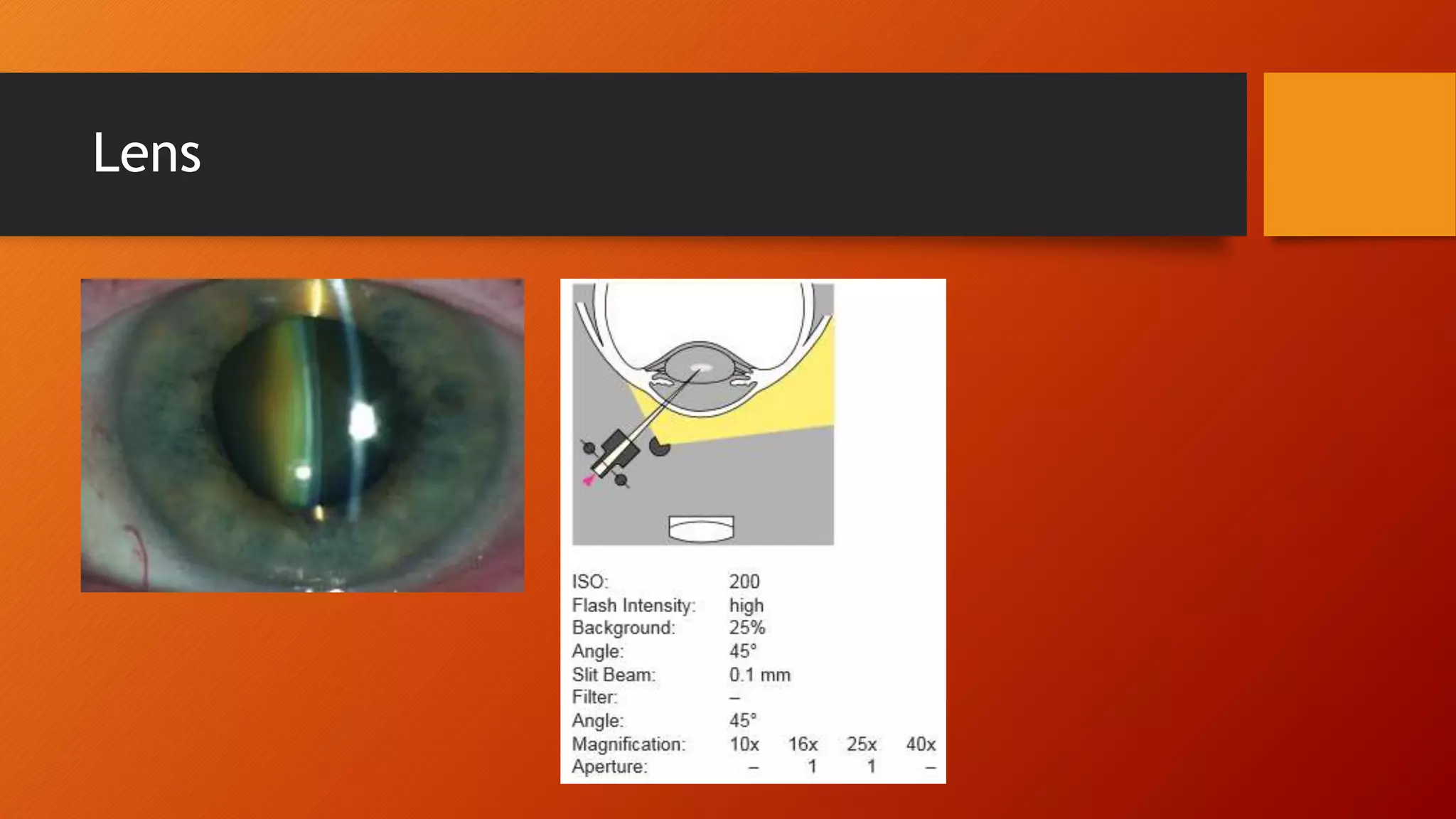 Slit lamp (methods of illumination) | PPTX