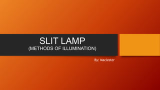 Slit lamp (methods of illumination) | PPTX