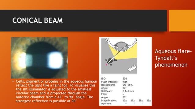 Slit lamp (methods of illumination) | PPTX | Eye and Vision Conditions ...