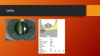 Slit lamp (methods of illumination) | PPTX