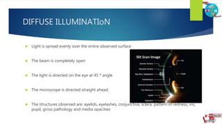 Slit lamp | PPT