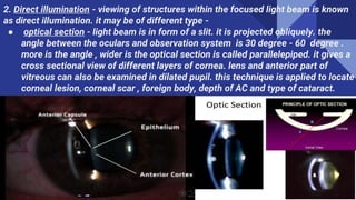 Slit lamp | PPT