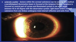 Slit lamp | PPT