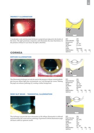 Slit lamp | PDF