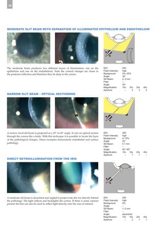 Slit lamp | PDF