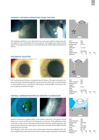 Slit lamp | PDF