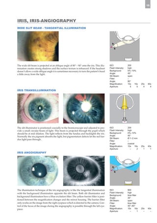 Slit lamp | PDF