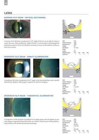 Slit lamp | PDF