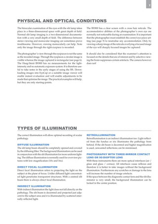 Slit lamp | PDF