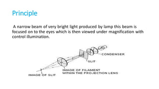 Slit lamp | PDF | Eye and Vision Conditions | Diseases and Conditions