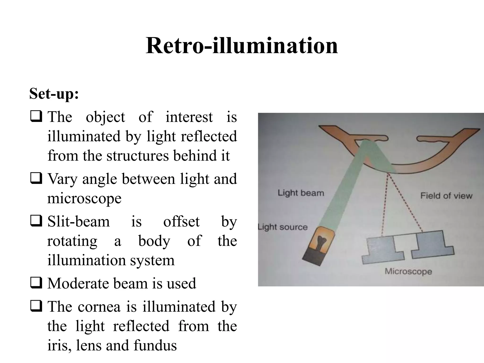 SLIT LAMP | PPTX