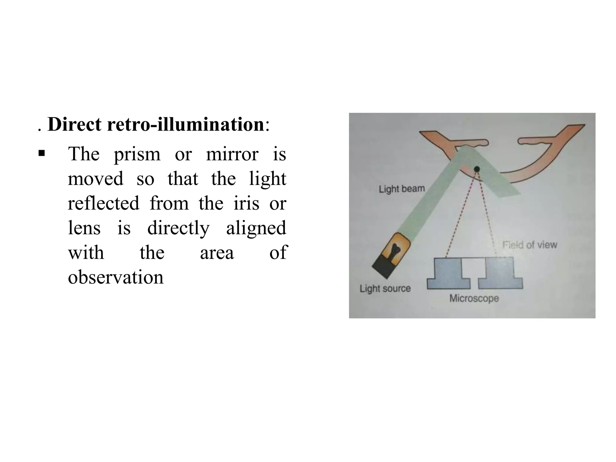 SLIT LAMP | PPTX