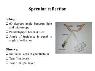 Specular Reflection Slit Lamp Technique