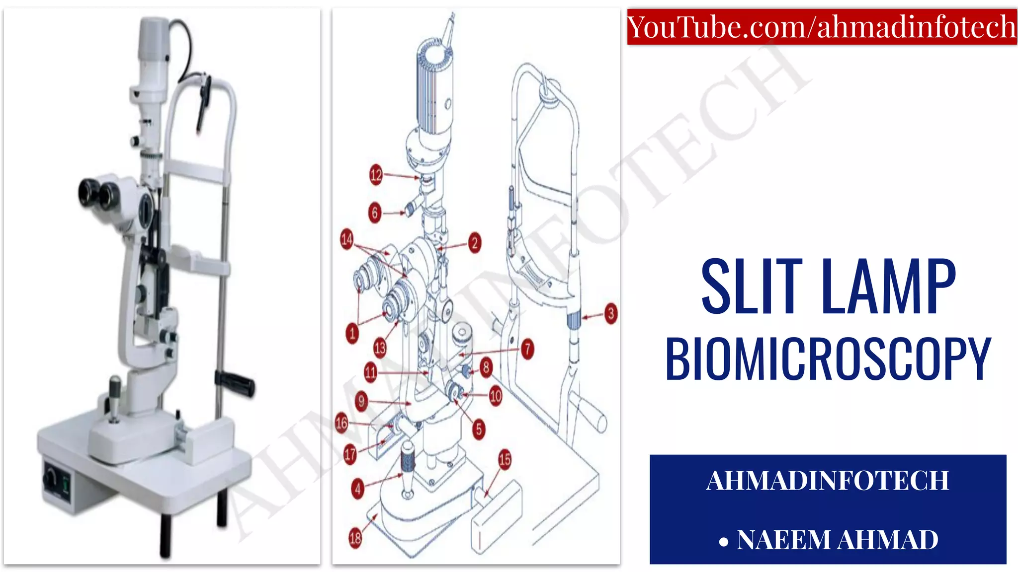 what is slit lamp Biomicroscopy | What is a slit lamp exam used for ...