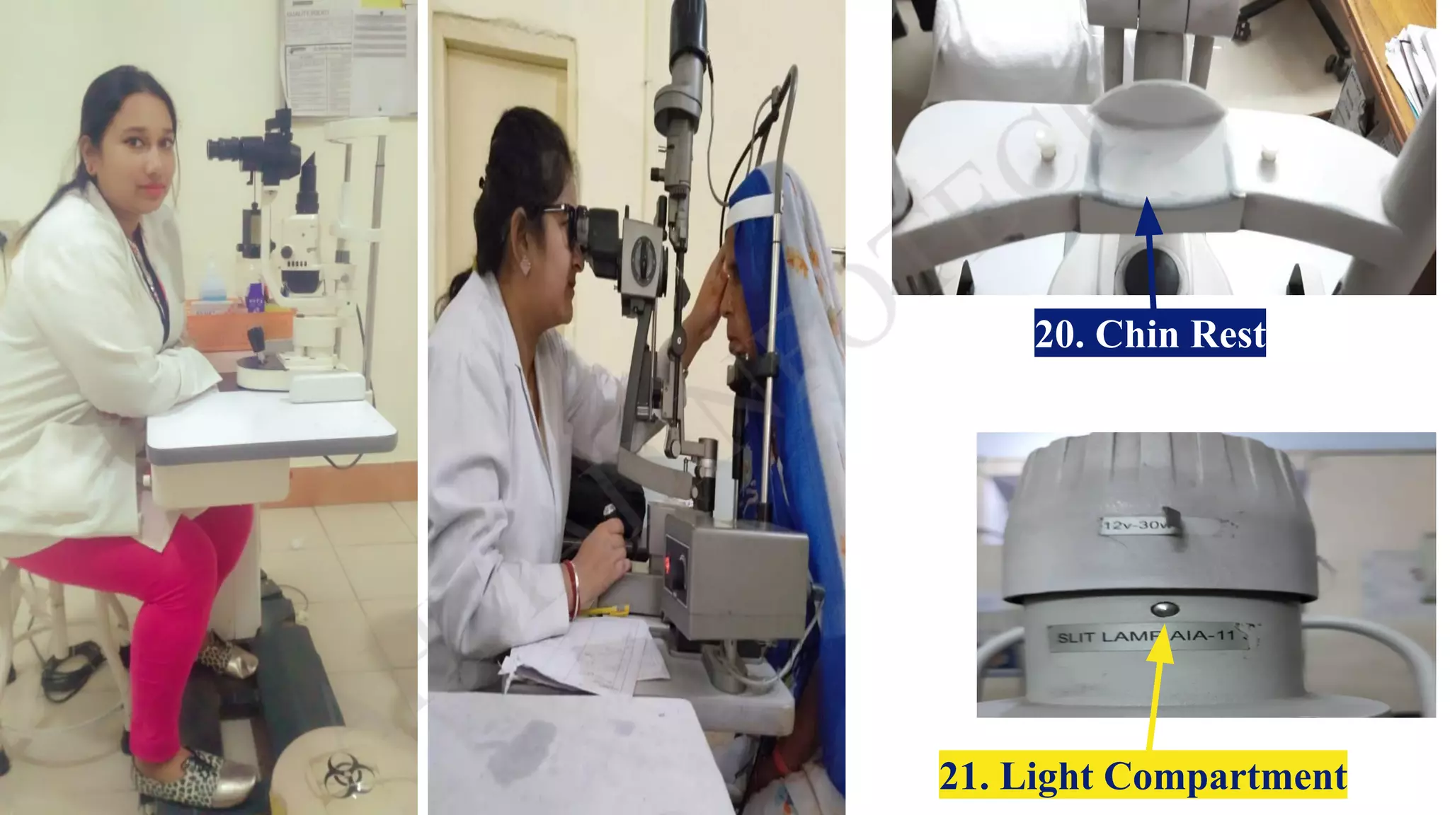 what is slit lamp Biomicroscopy | What is a slit lamp exam used for ...