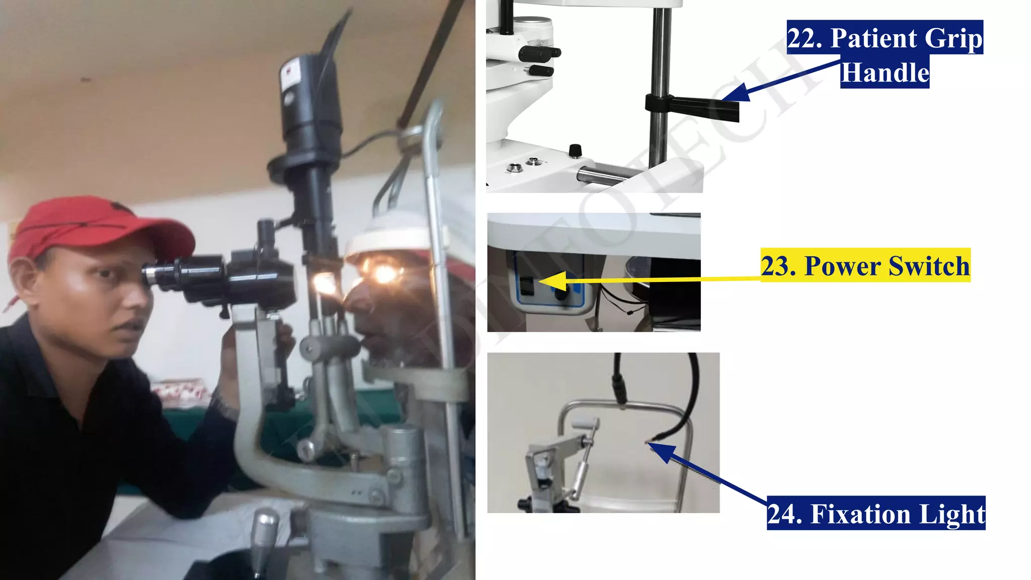 what is slit lamp Biomicroscopy | What is a slit lamp exam used for ...