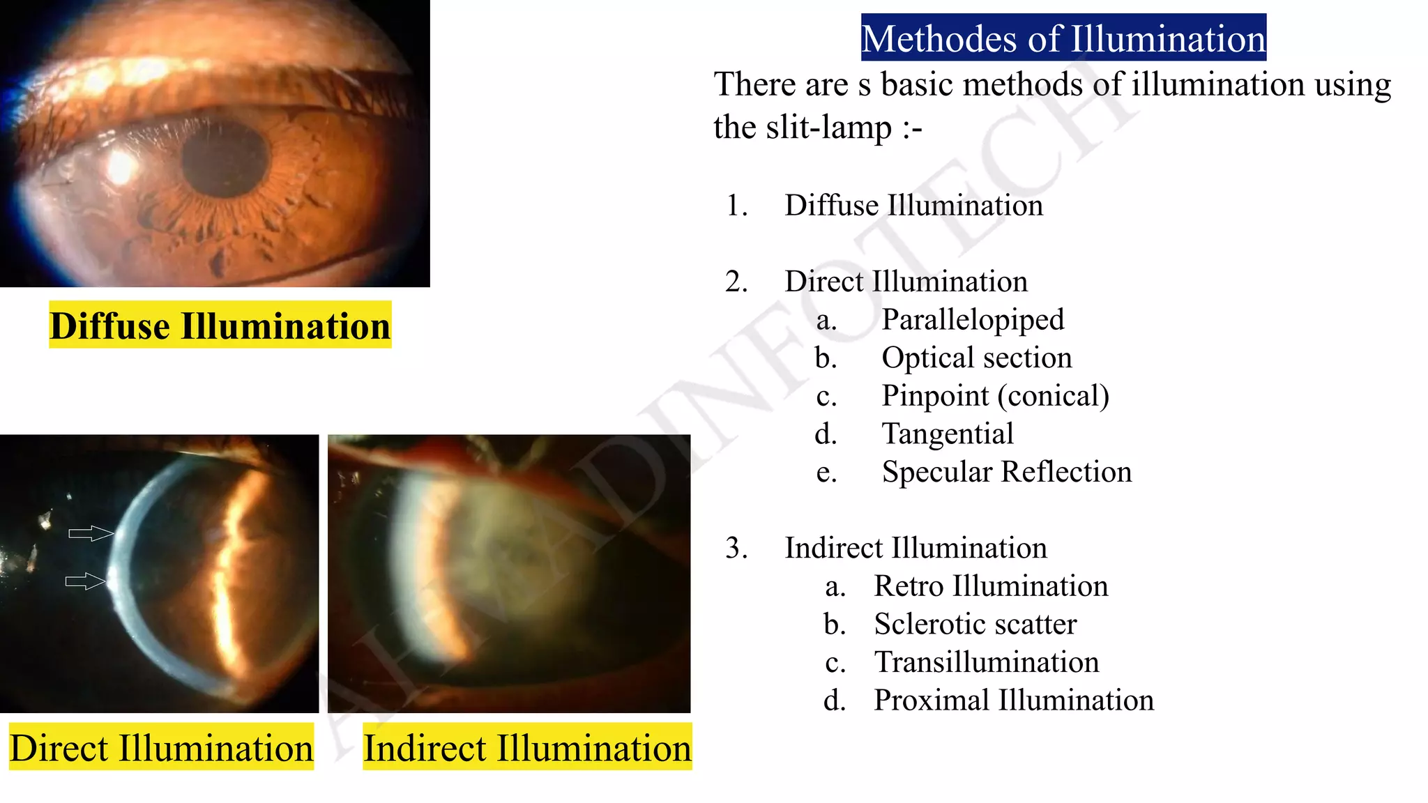 what is slit lamp Biomicroscopy | What is a slit lamp exam used for ...