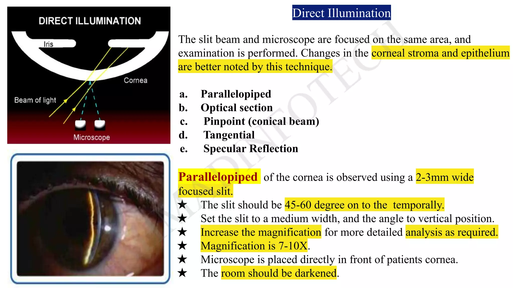 what is slit lamp Biomicroscopy | What is a slit lamp exam used for ...
