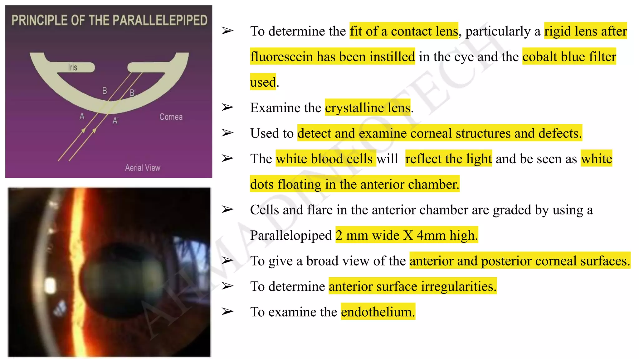 what is slit lamp Biomicroscopy | What is a slit lamp exam used for ...