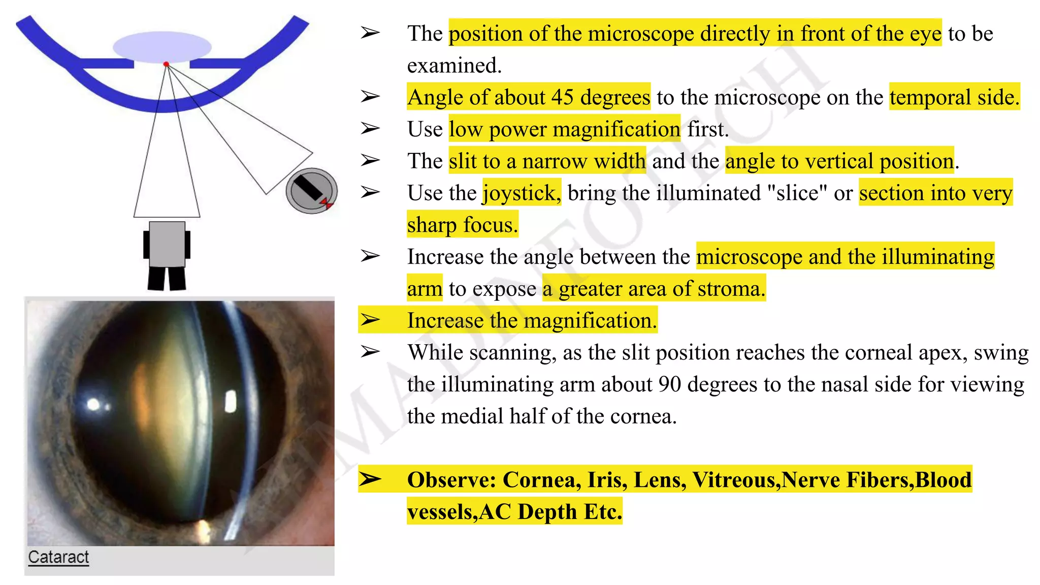 what is slit lamp Biomicroscopy | What is a slit lamp exam used for ...